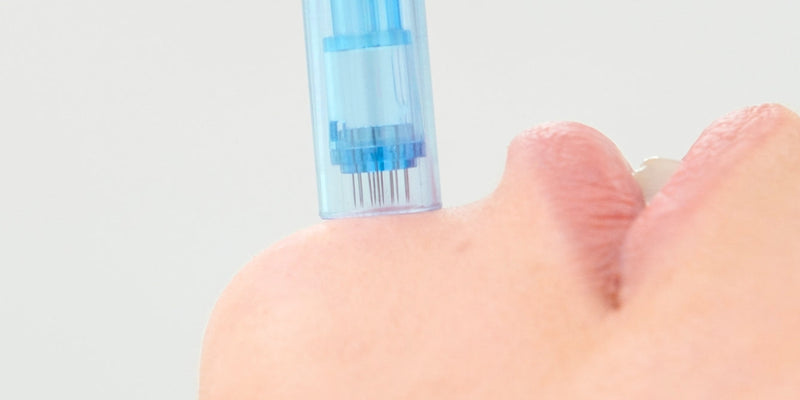 Microneedling: The Trend, The Truth, and The Game-Changing Alternative ...