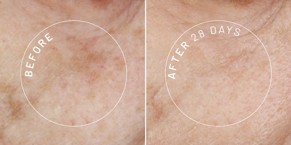 Shield & Repair: The Ultimate Guide to UV Protection and Reversing Sun ...