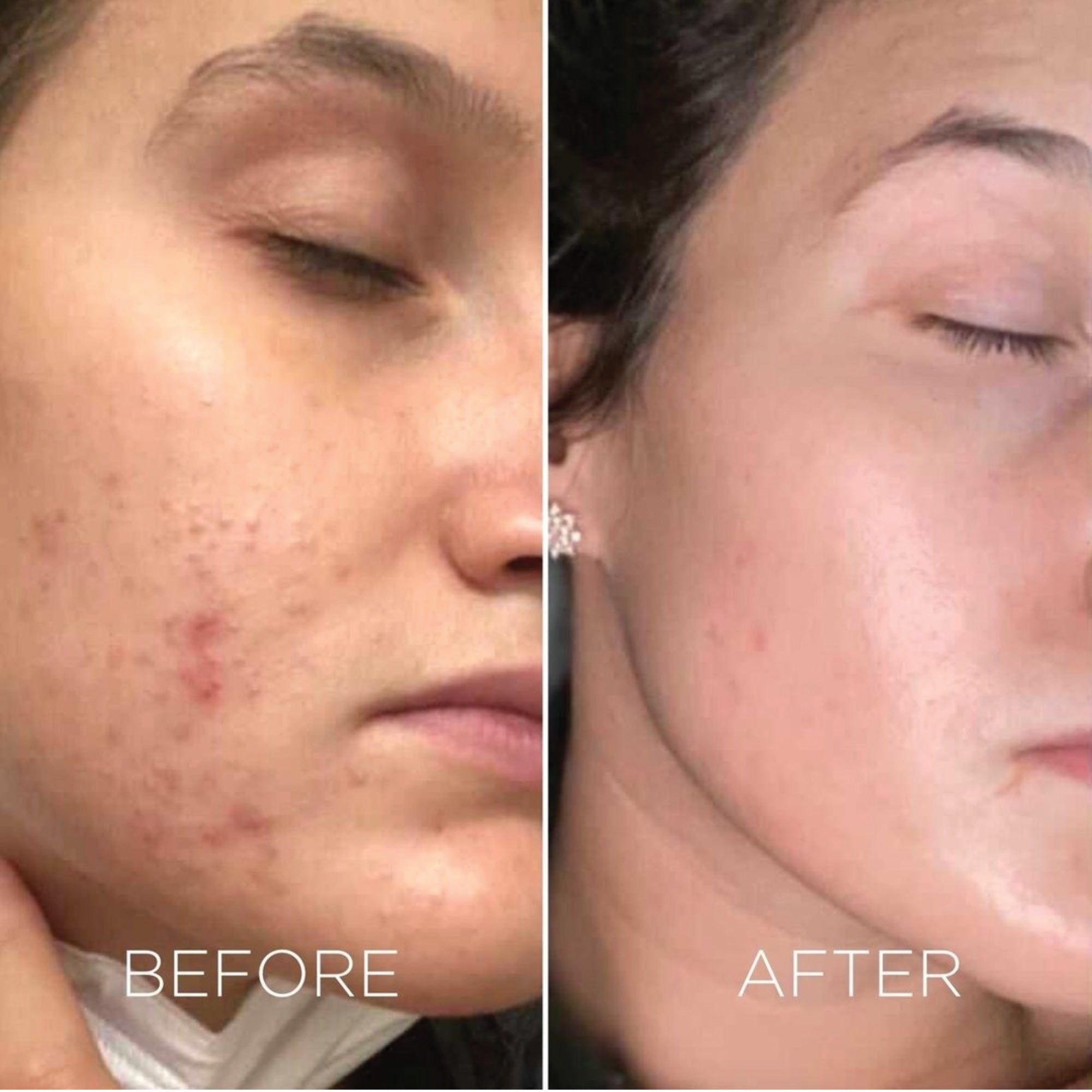 BRIGHT THIS WAY Dark Spots No More™ - Dr. Brandt Skincare