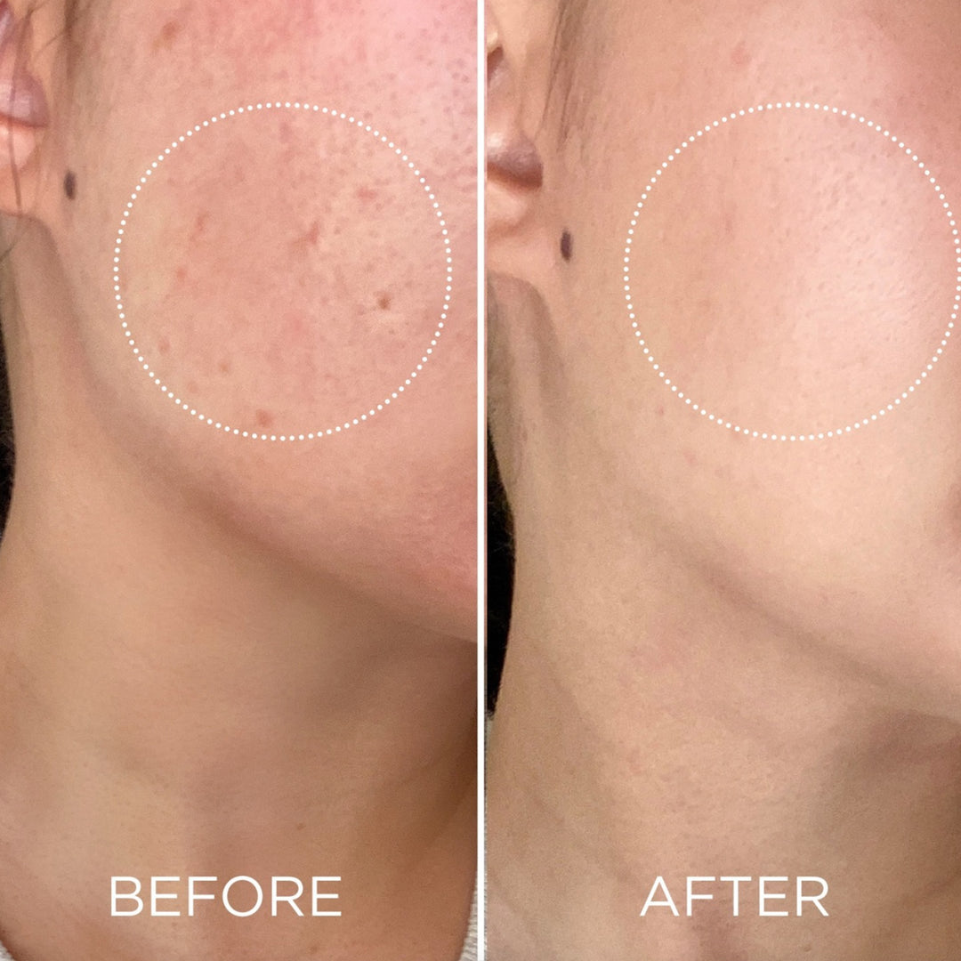 BRIGHT THIS WAY Dark Spots No More™ - Dr. Brandt Skincare