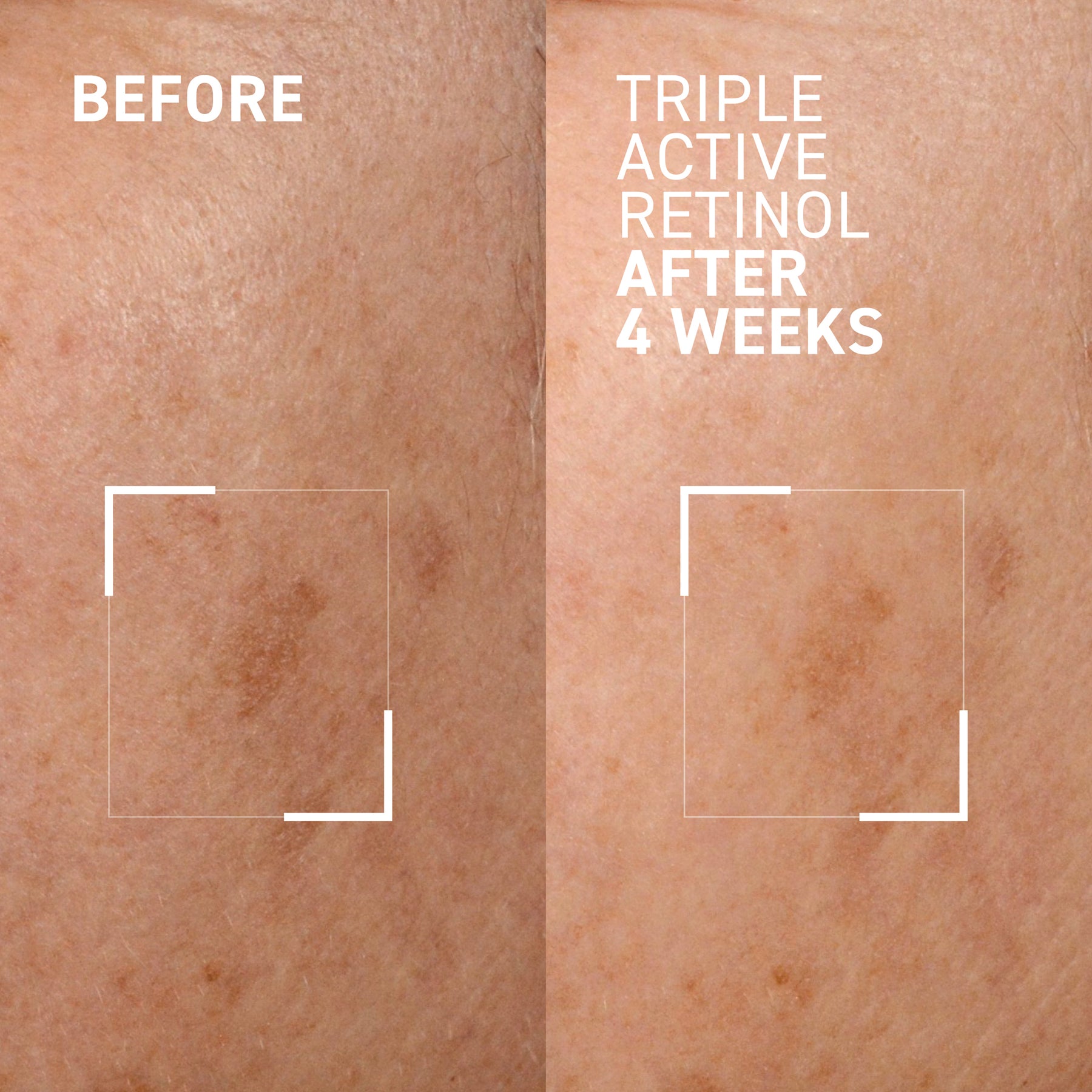 Retinol Collection for Smoother, Younger Skin | Dr. Brandt Skincare