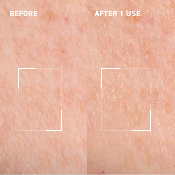 Overnight hydrating face mask - Calm Flow Gel - Dr. Brandt Skincare