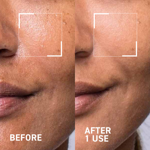 Pore purifying cleanser - Pores no more I Dr. Brandt Skincare