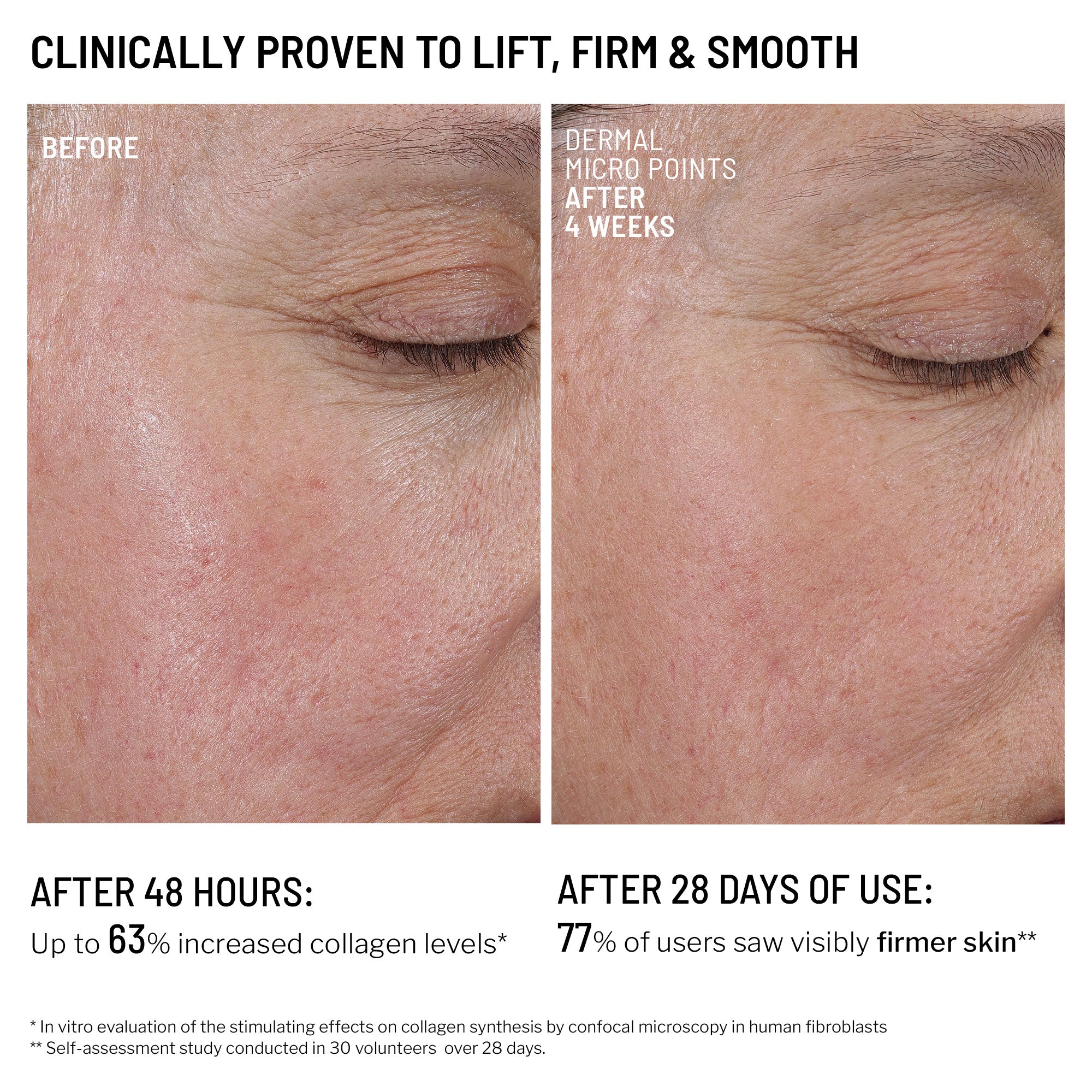 Microneedling Recovery Kit - Dr. Brandt Skincare