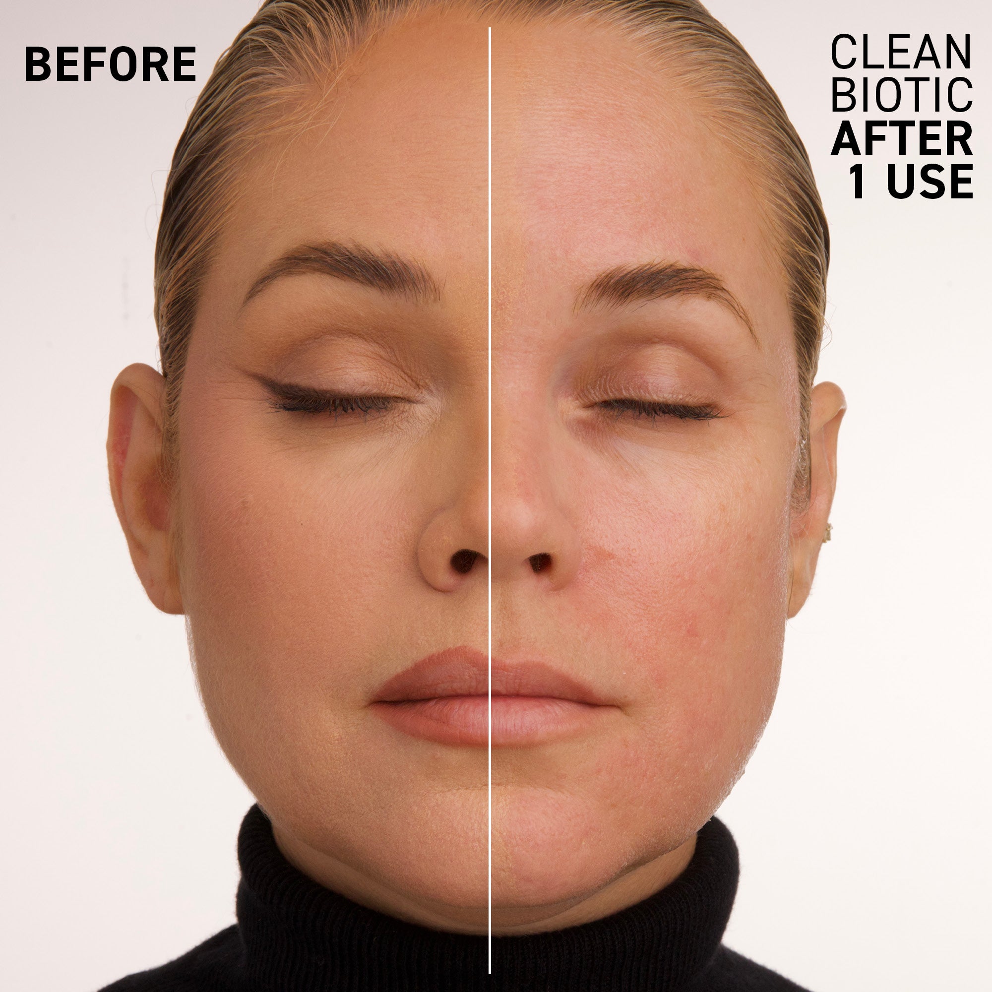 Biotic Skincare for Healthy Radiance | Dr. Brandt Skincare